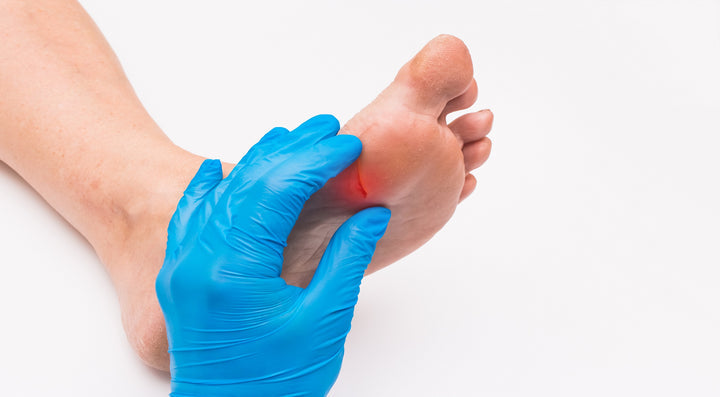 “Cutting” into Foot Health: Understanding the Risks and Prevention of ...